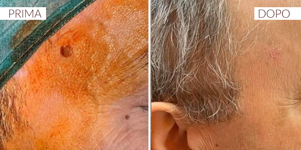 Chirurgia dermatologica - Sabina Medica Chirurgia dermatologica - Sabina Medica